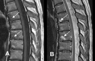 Fig 59 C. Lesiones Romanus.