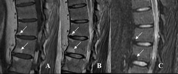 Fig 59 G. Lesiones Romanus.
