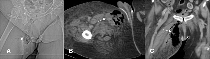 Documento sin título