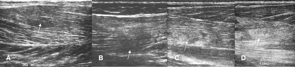 Documento sin título