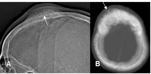 Documento sin título
